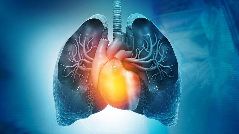 Aficamten Beneficial for Obstructive Hypertrophic Cardiomyopathy