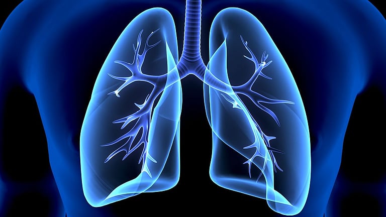 Alternative Criteria IDs High-Benefit Groups for Lung Cancer Screening