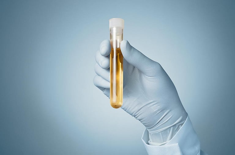 Urine Test Shows Promise for Early Autism Detection, Study Finds