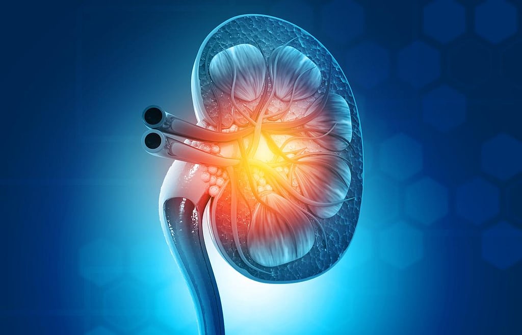 EBV-Seropositive Donor Kidneys Up PTLD Risk in Seronegative Recipients