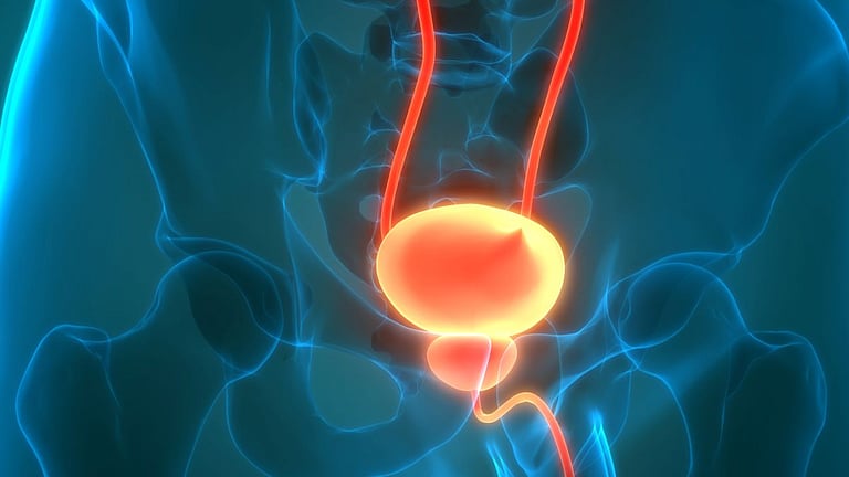 Apalutamide + ADT Beneficial in High-Risk Localized Prostate Cancer