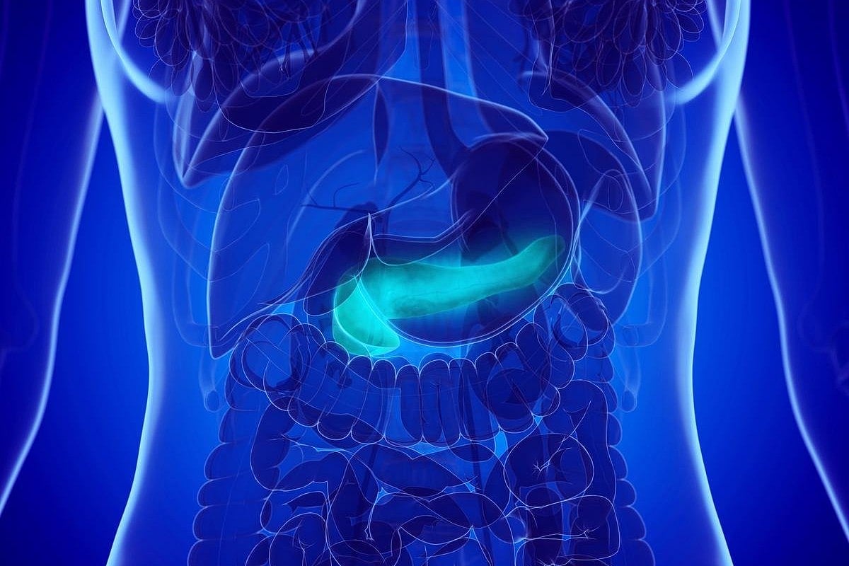 FDA OKs Noninvasive Optune Pax Device for Advanced Pancreatic Cancer