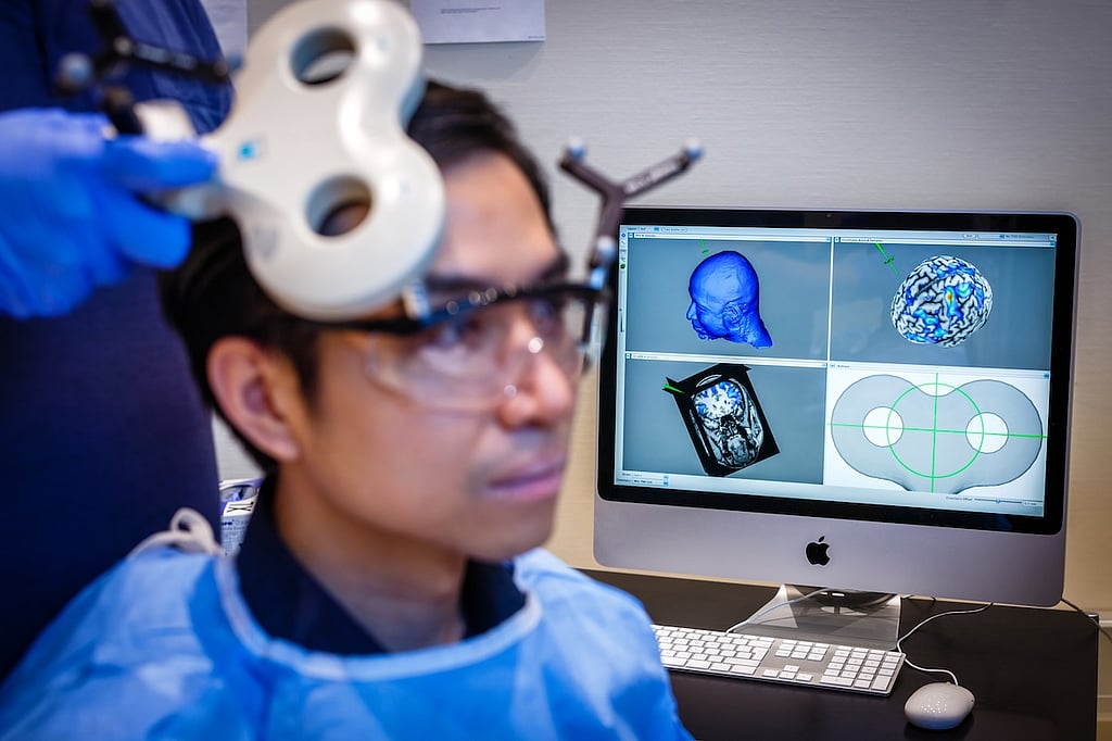 Brain Stimulation Reduces Selfishness, Study Finds