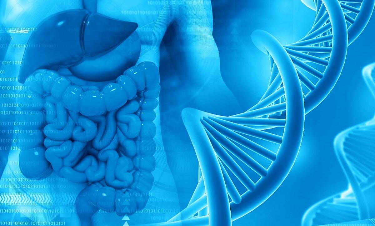 Genetic Determinant of Severe Disease Identified in IBD