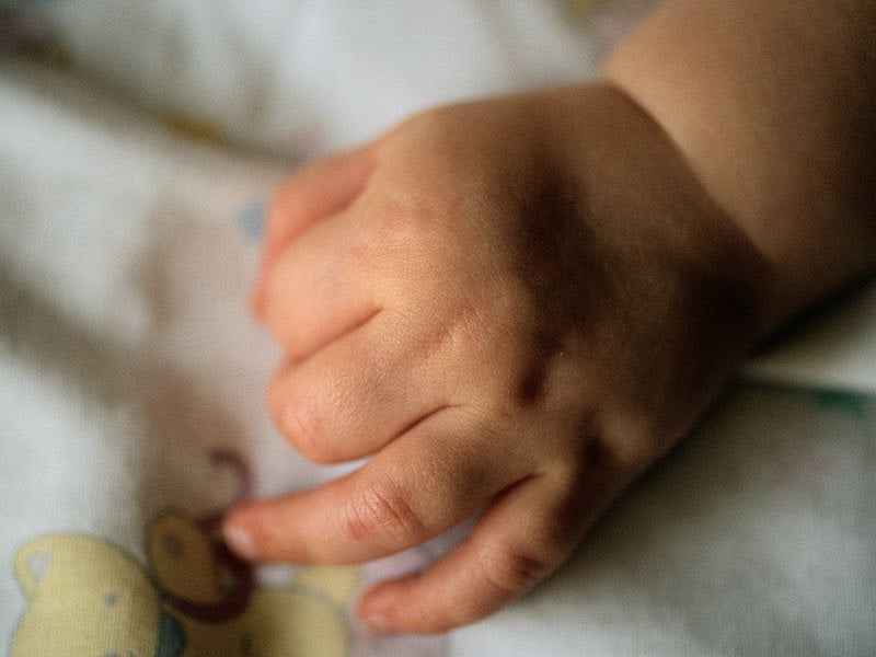 Rare Set of 'Semi-Identical' Twins Identified in Australia