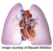 Poor Lung Function Linked to Heart Failure in Study