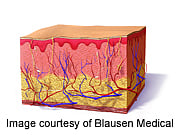 New 'Bioengineered Skin' Gets Closer to the Real Thing