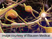 Interneuron Transplant Treats Neuropathic Pain in Mice