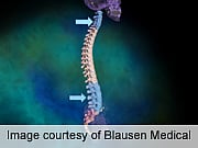 Factors Tied to Neck, Back Pain Improvement Identified