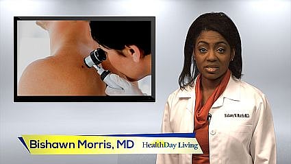 How to Do a Skin Cancer Body Check