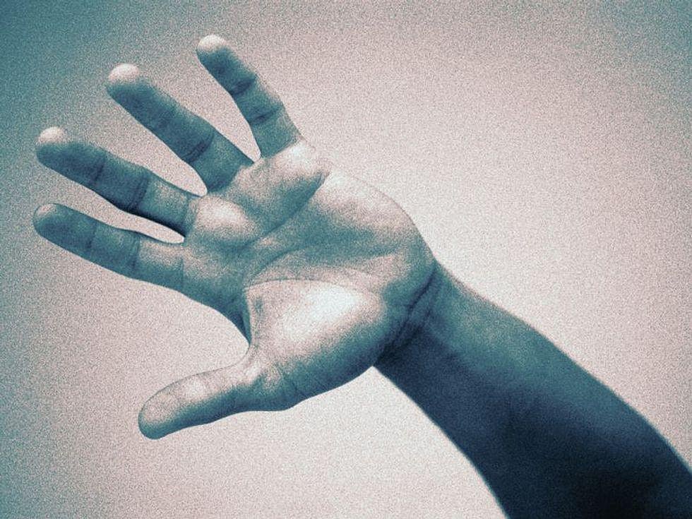 Inflammation at IP Thumb Joint Common in Psoriatic Arthritis