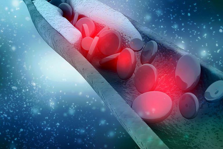 Blood Clots: What They Are, Causes, Symptoms & Treatment