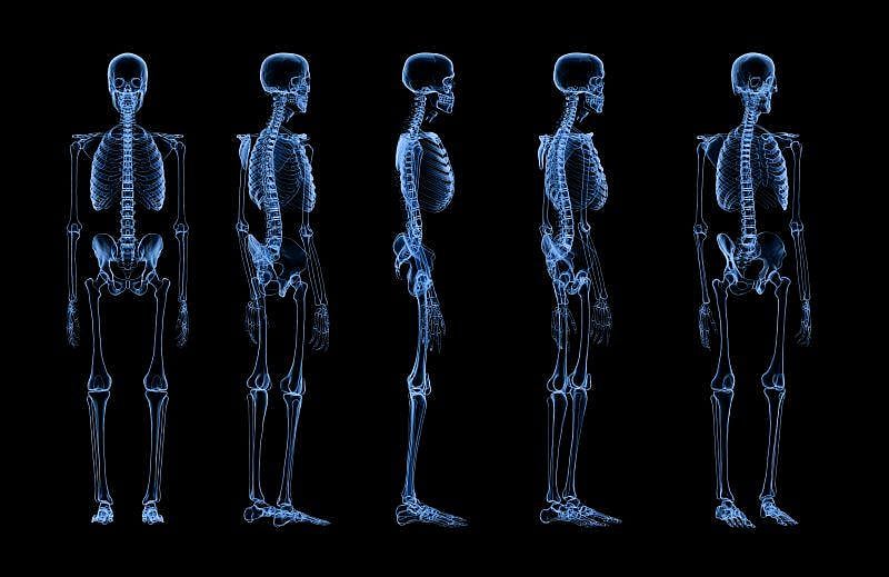 Bone Scintigraphy Can Help ID Cardiac Amyloidosis