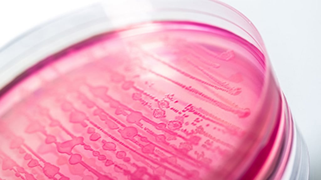 E. Coli: What It Is, Causes, Symptoms & Treatment