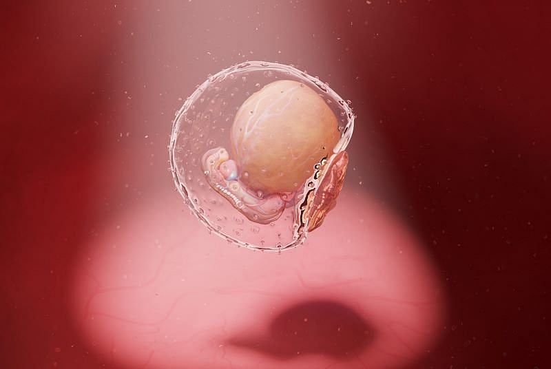 Embryonic Development Delayed in Pregnancies Ending in Miscarriage