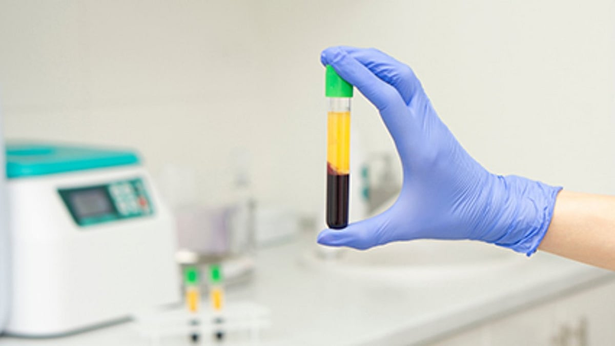 Early Cancer Detection Enhanced By New Sex Specific Protein Panels