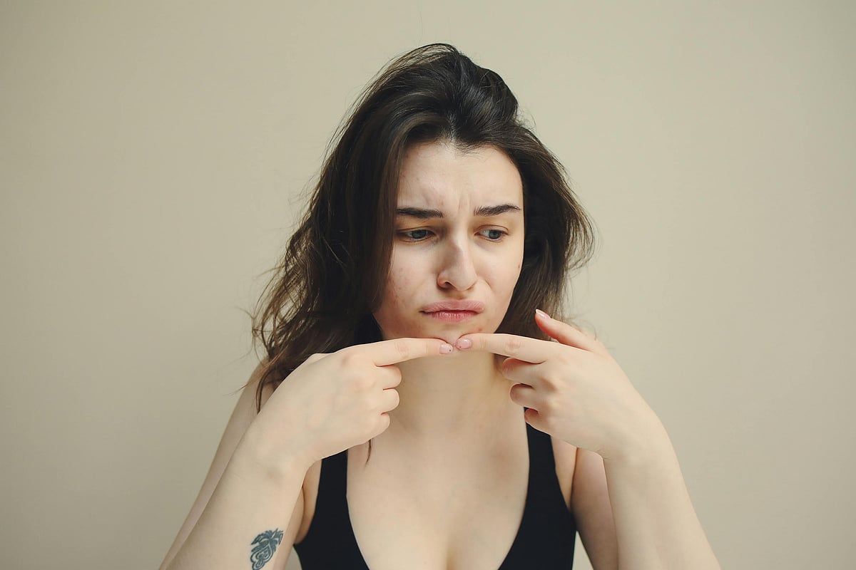 What are electric acne patches and do they actually work?