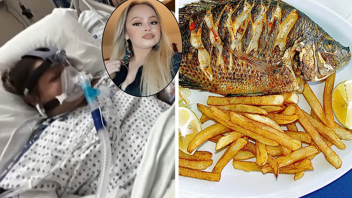 america woman loses all her limbs after eating contaminated fish