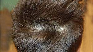 தலையில் இரட்டை சுழி பரம்பரை மரபு மற்றும் ஜோதிட அர்த்தங்கள் - அதிசய ...