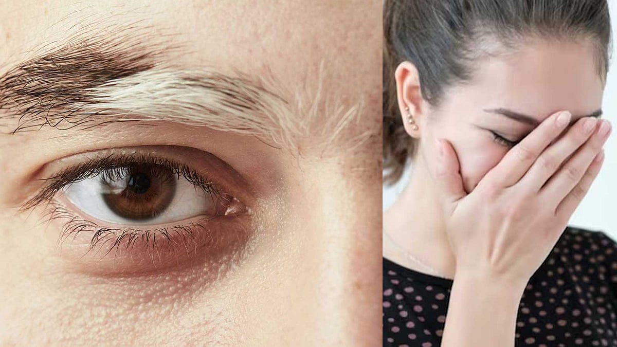 புருவங்களில் நரை முடி காரணங்கள் - ஊட்டச்சத்து, மன அழுத்தம் & தீர்வுகள் ...