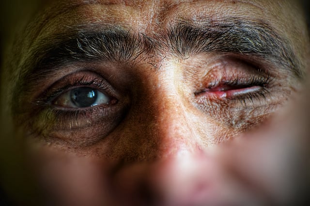 Kashmir's Forgotten Victims: Navigating Life After Pellet Injuries