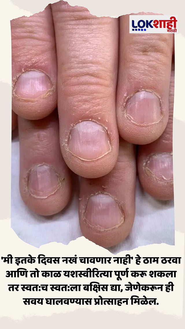 Habit of biting Nails: नखं खाणं बंद करण्यासाठी करा 'हे' उपाय...