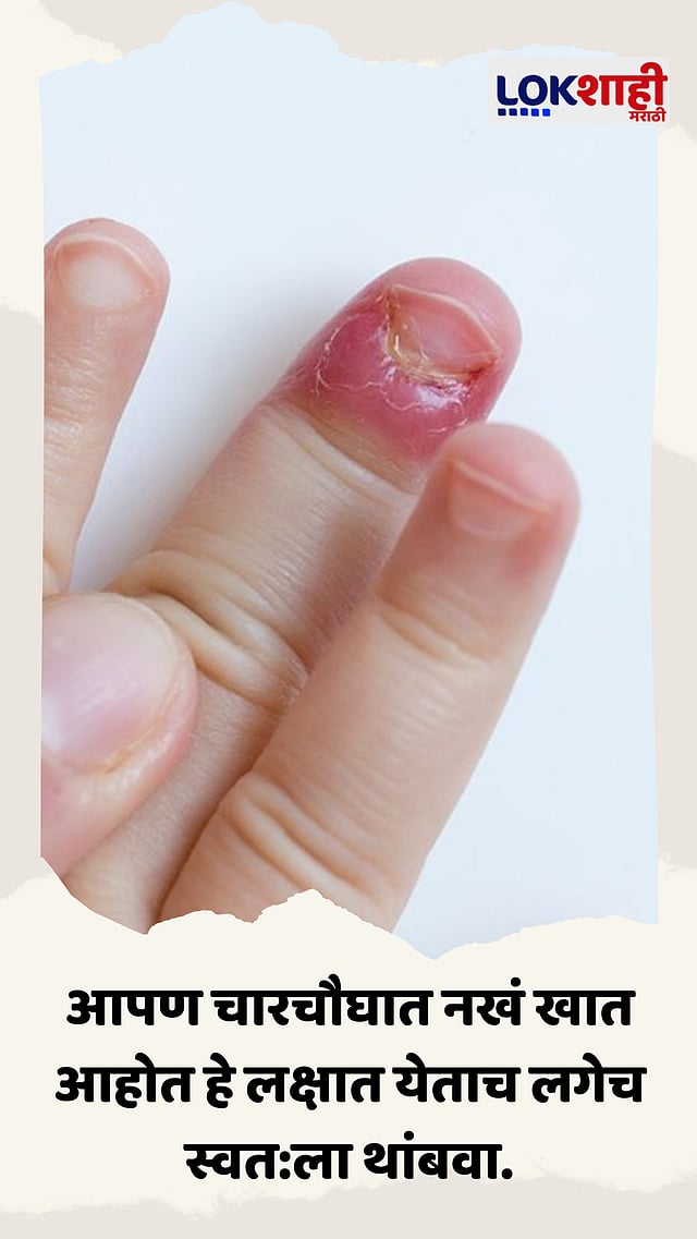 Habit of biting Nails: नखं खाणं बंद करण्यासाठी करा 'हे' उपाय...