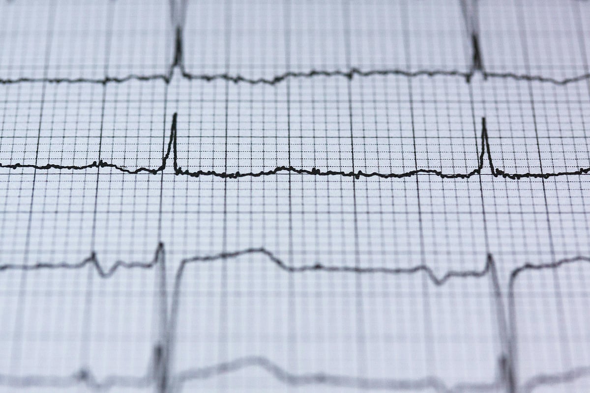Normal ECG Does Not Rule Out Heart Problems : Dr. Chaitanya