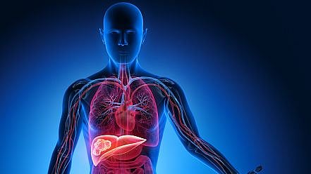 Study reveals: p53 in liver cancer, is this an ultimate betrayal