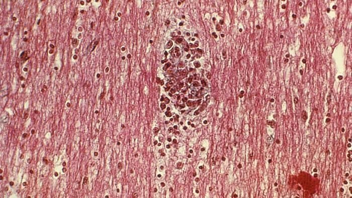 Part-Time ‘Janitor’ Cell Cleans Up the Nervous System