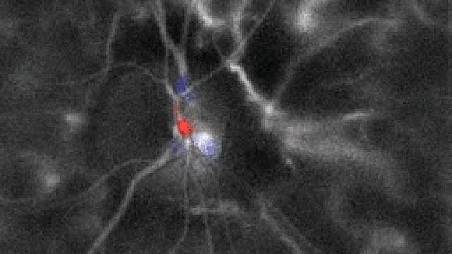 Essential Step in Recharging the Eye’s Light-Sensing Retina