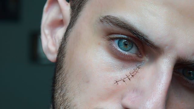 Facial Scars and First Impressions