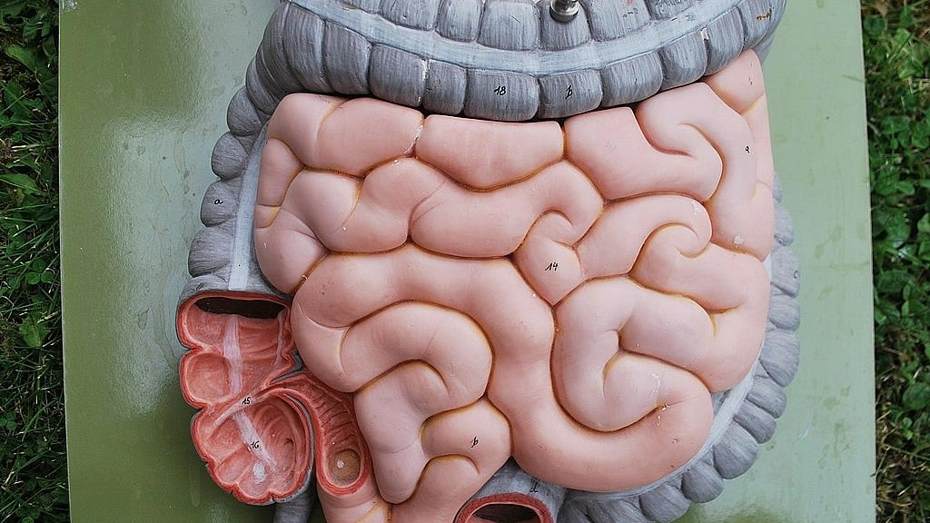 Intestines Twisted