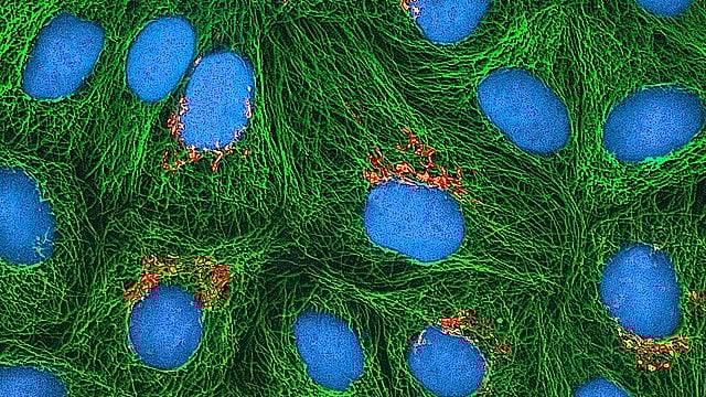 Hela Cells: The Genes That Saved Generations