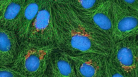 Hela Cells: The Genes That Saved Generations