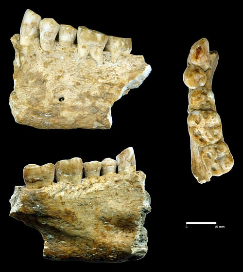 History and Evolution of Dental Filling Materials from Prehistoric to ...