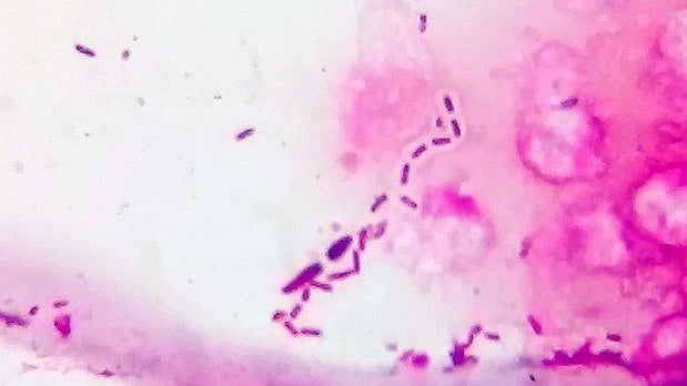 Gut Bacteria Use Super-Polymers to Dodge Antibiotics