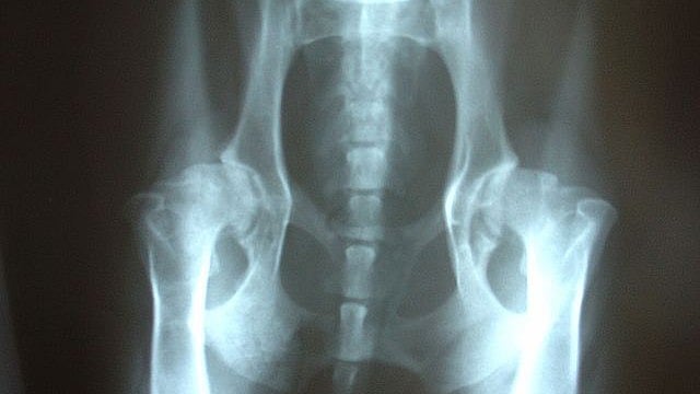 Hip Dysplasia in Young Athletes: Evaluation, Assessment and Diagnosis