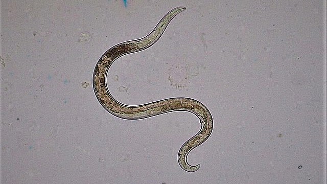 Live worm found in Australian woman’s brain in world-first discovery