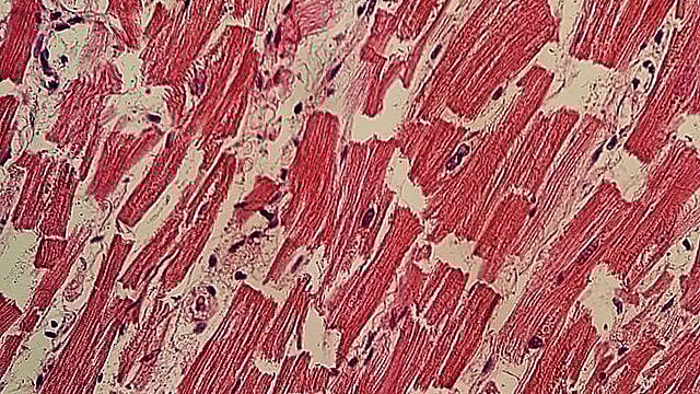 First Classification of Four Stages of Heart Attack Based on Heart ...