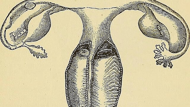 Very Rare Case: Alabama Woman with Double Uterus Pregnant in Both
