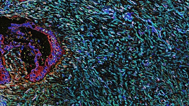 Revolutionary CL-iSCAT Microscope Reveals Intracellular Traffic Jams