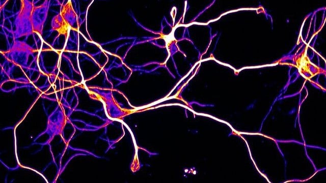 How Good can Overpower Evil in the Genetic Determination of Alzheimer’s ...