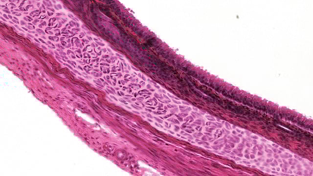 Rare Case: Man Tears His Windpipe by Holding Sneeze