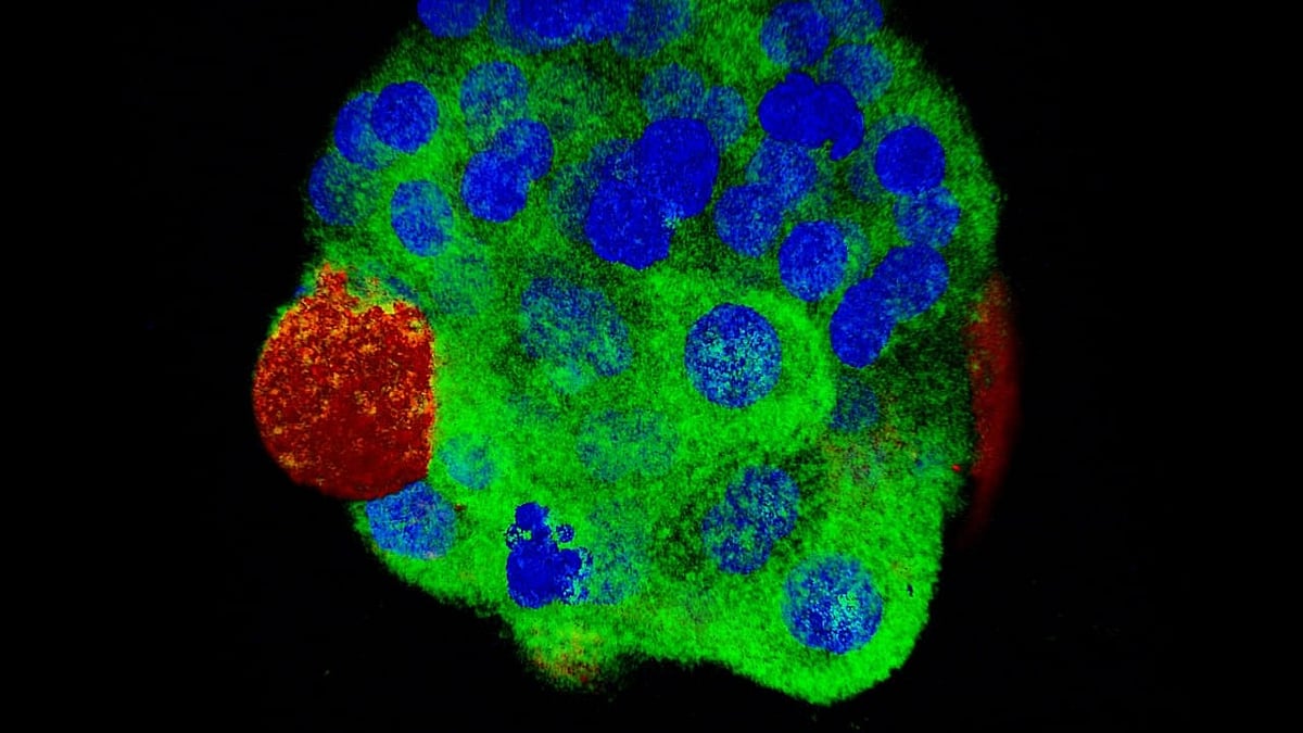 Using Vibrator Found in Cell Phones, Researchers Develop 3D Tumor Spheroids