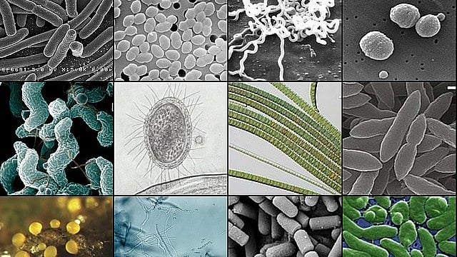 More Than Thirty New Species of Bacteria Discovered in Patient Samples