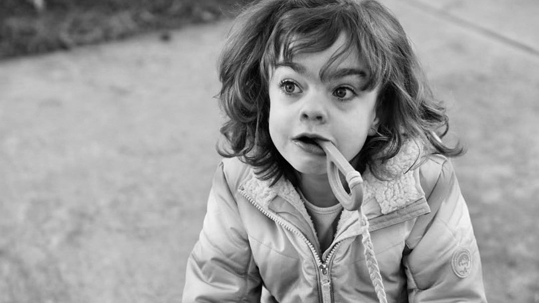 Progressive Loss of Developmental Skills in Childhood Dementia ...