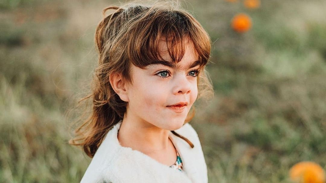 Progressive Loss of Developmental Skills in Childhood Dementia ...