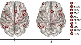Brain Connectivity Patterns Differ between Pre-term and Term Babies
