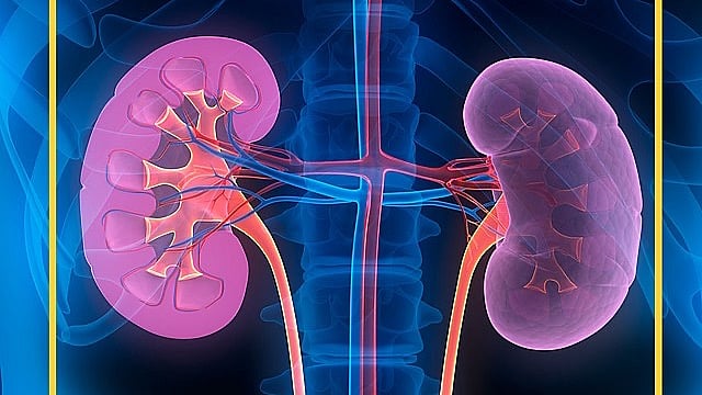 AIIMS-Delhi Performs First Dual Kidney Transplant on 51-year-old Patient